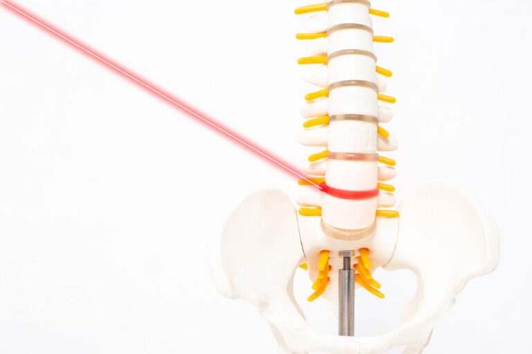 Laser Spine Surgery Cost | Penn Spine & Orthopedic