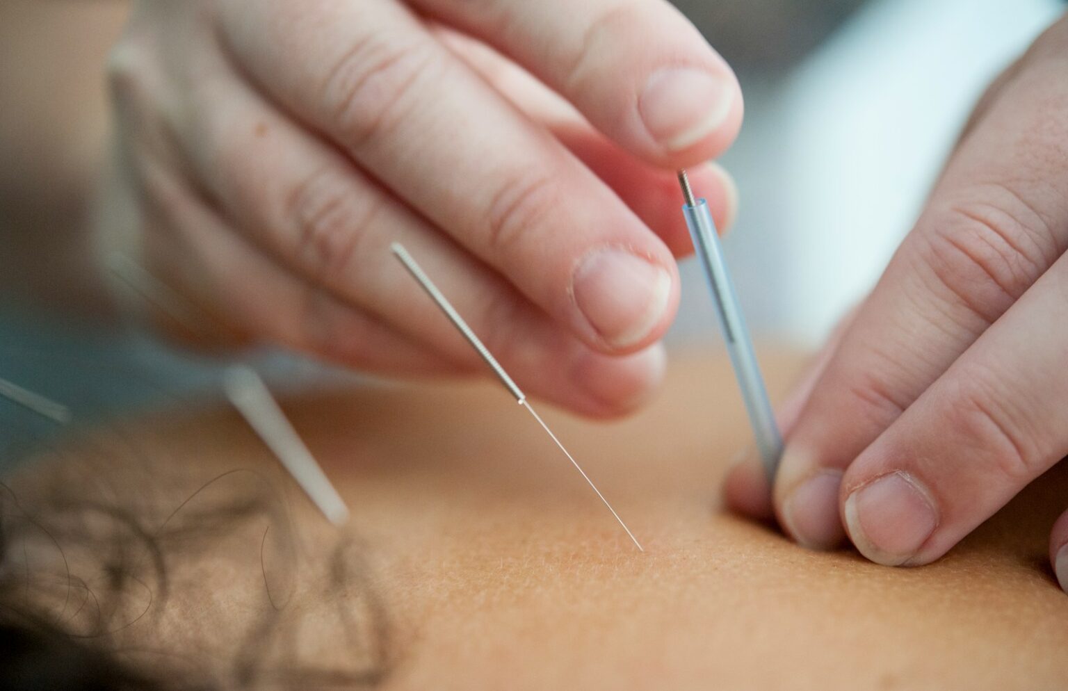 Alternatives to Spinal Fusion | Penn Spine & Orthopedic