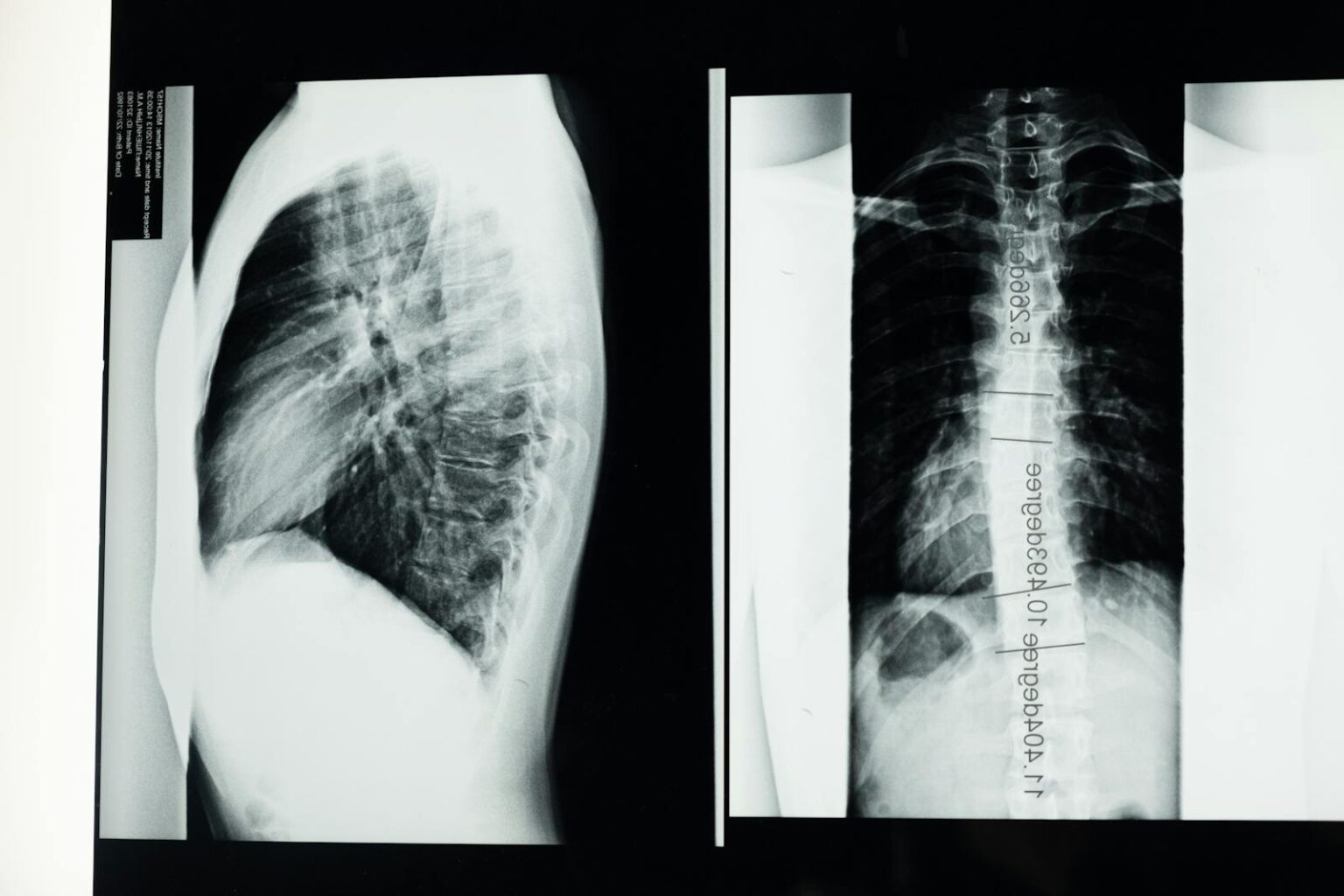 How Spine Injuries Are Diagnosed: Procedures and Techniques | Penn ...