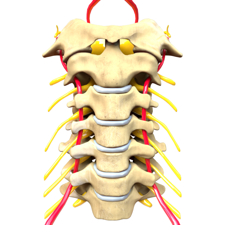 What to Expect After Disc Replacement Surgery of the Neck | Penn Spine ...